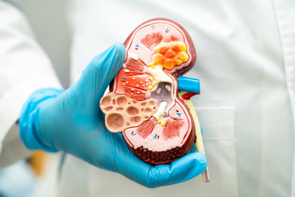 Tactical Understanding of Urinary Therapeutic Procedure Coding ...