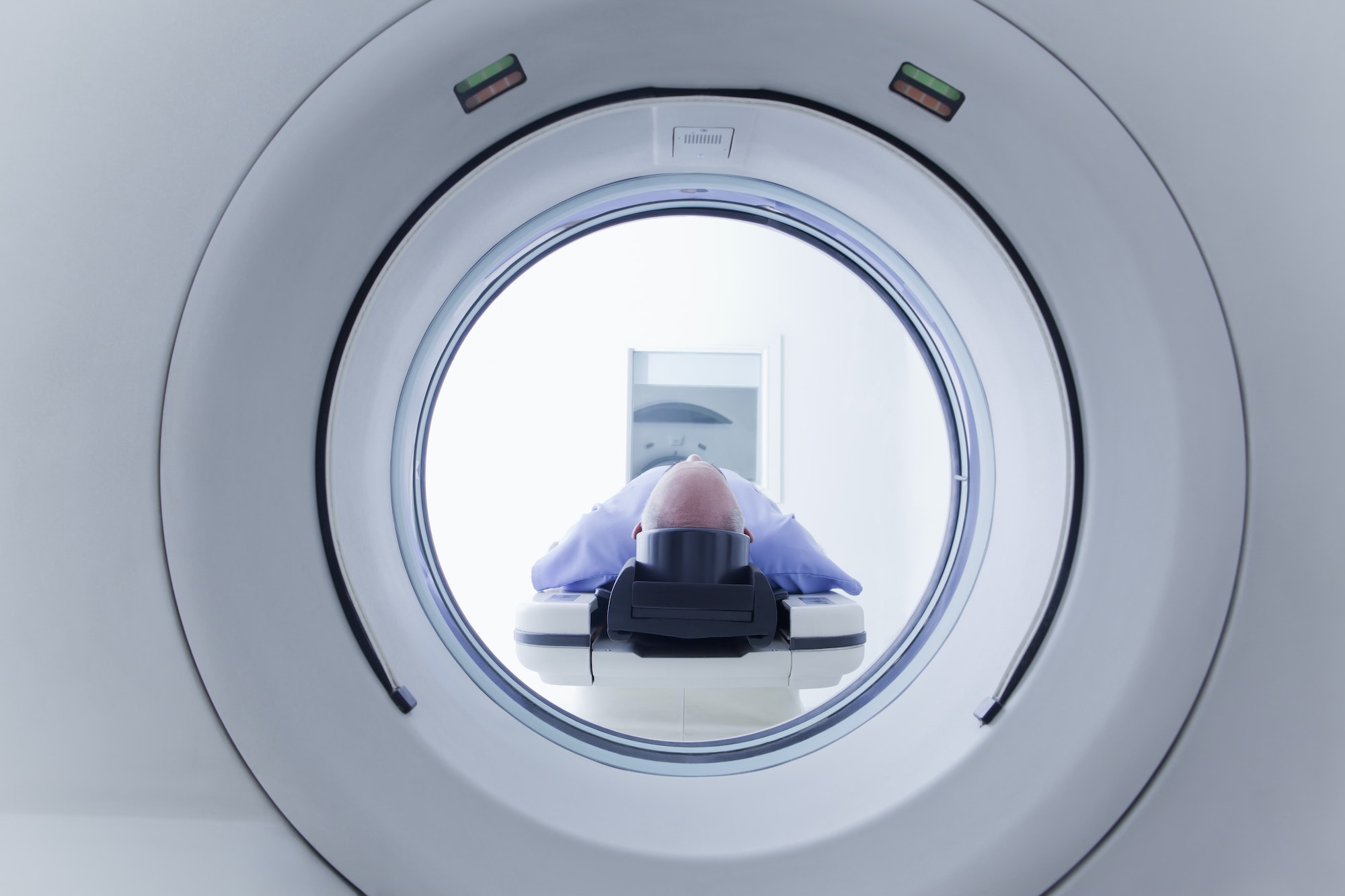 Unbundling CT Scans: A Renewed Focus – MedLearn Publishing